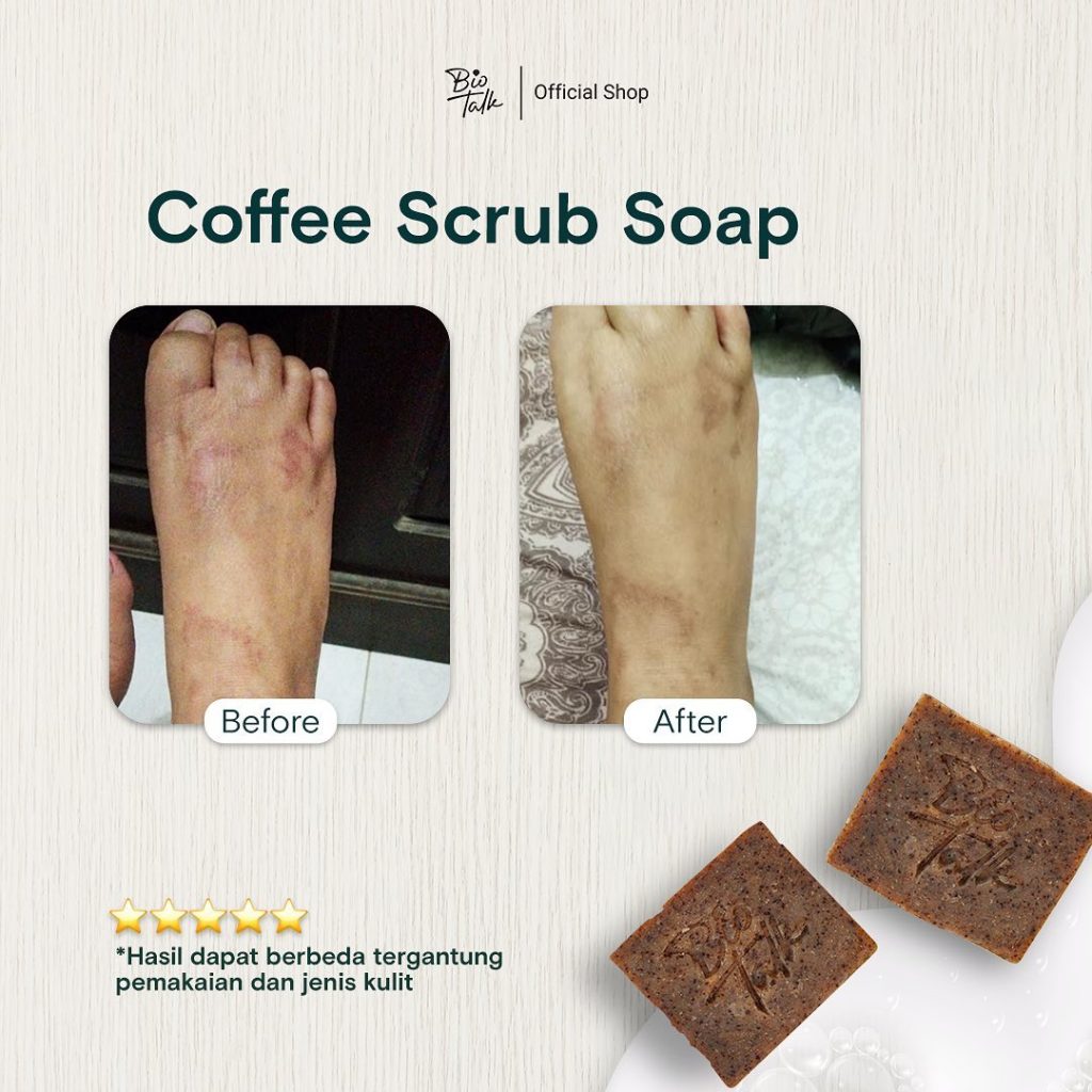 Coffee Scrub Memudarkan Bekas Luka | Biotalk