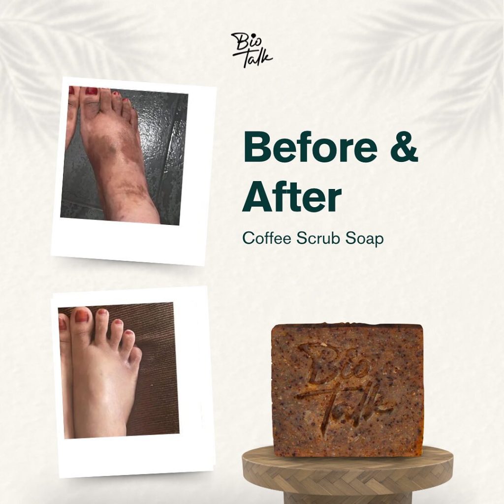 Coffee Scrub Memudarkan Bekas Luka | Biotalk