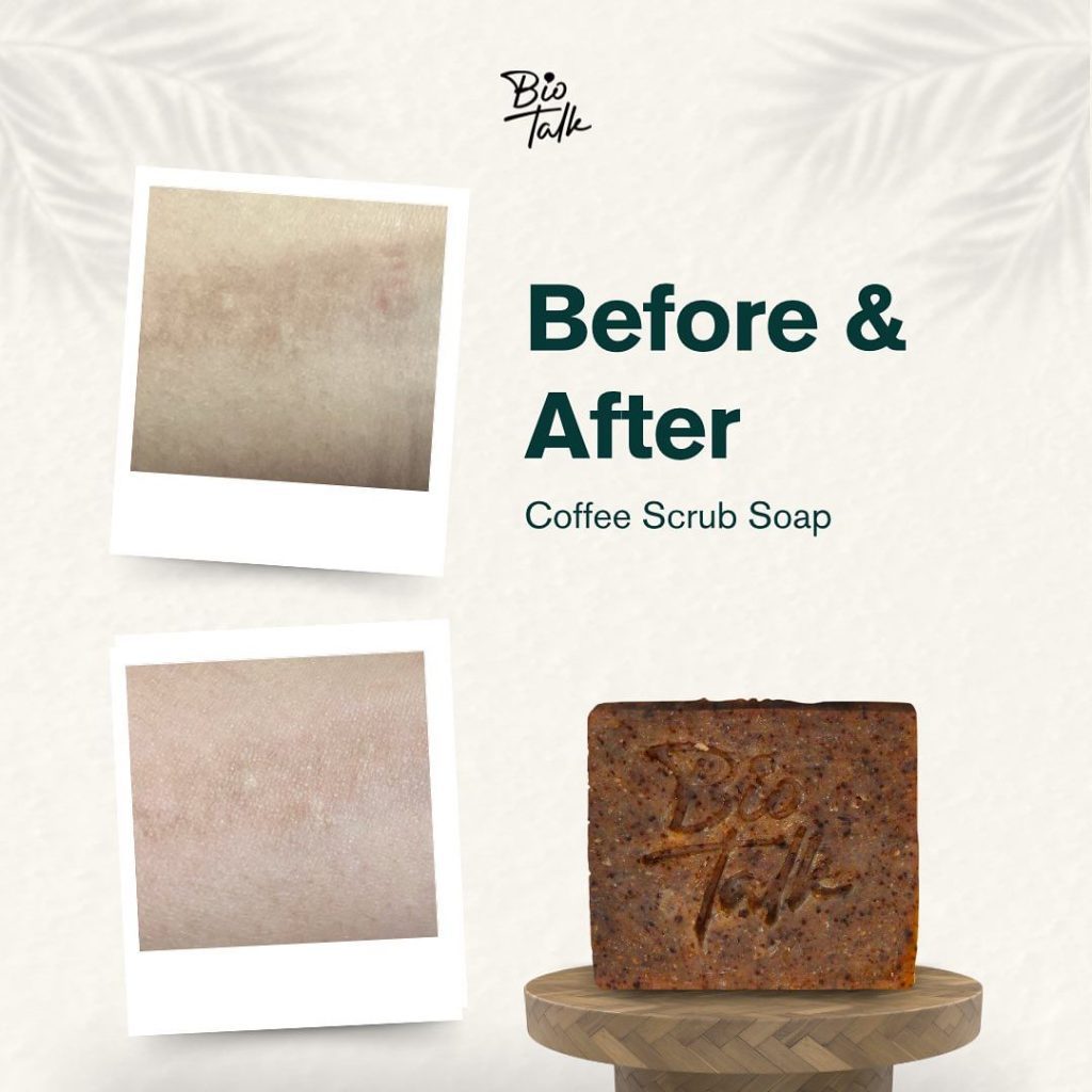 Coffee Scrub Memudarkan Bekas Luka | Biotalk