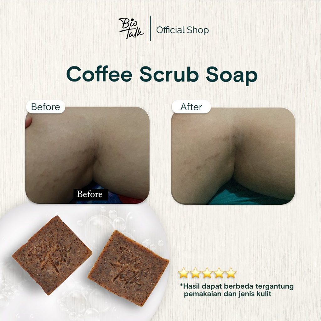Coffee Scrub Memudarkan Bekas Luka | Biotalk