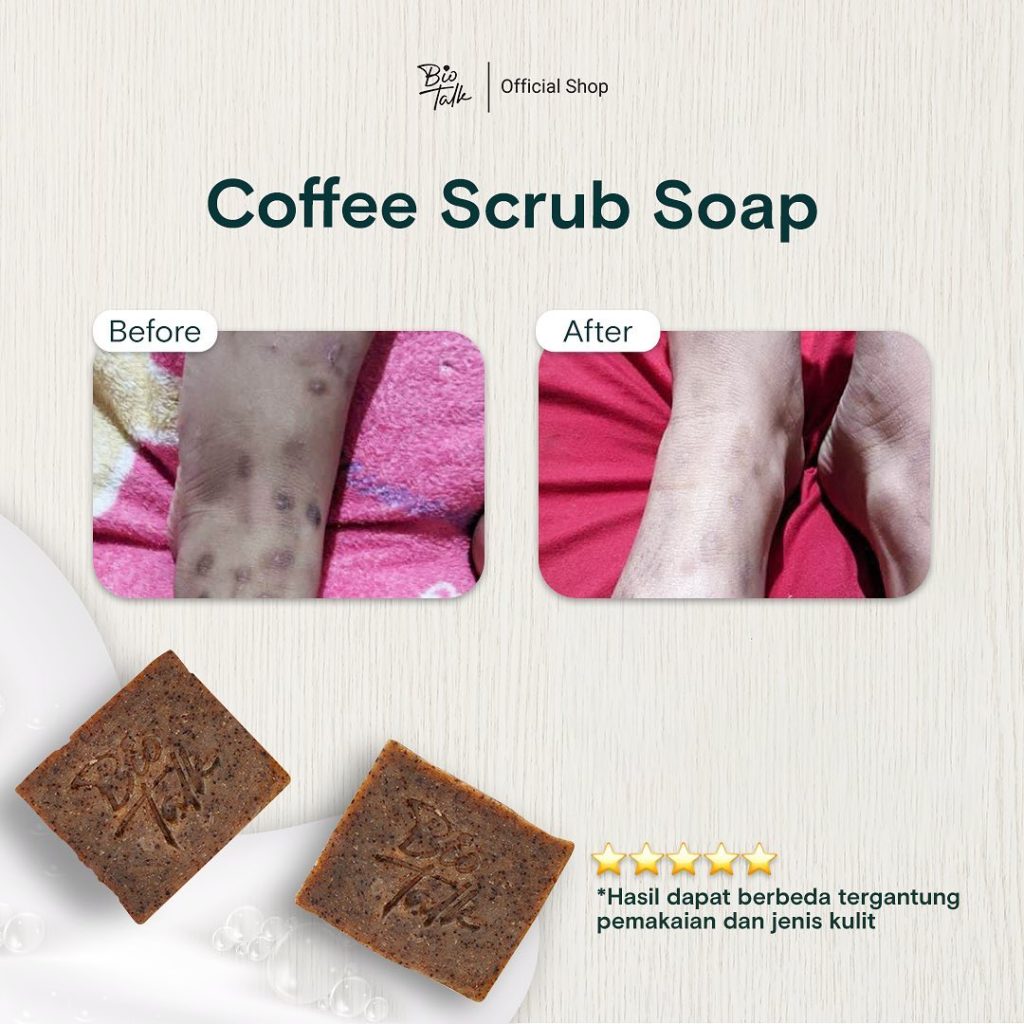 Coffee Scrub Memudarkan Bekas Luka | Biotalk